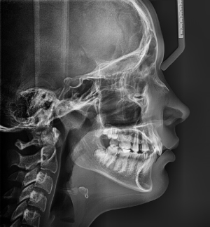 Usluge – Snimanje zuba Beograd